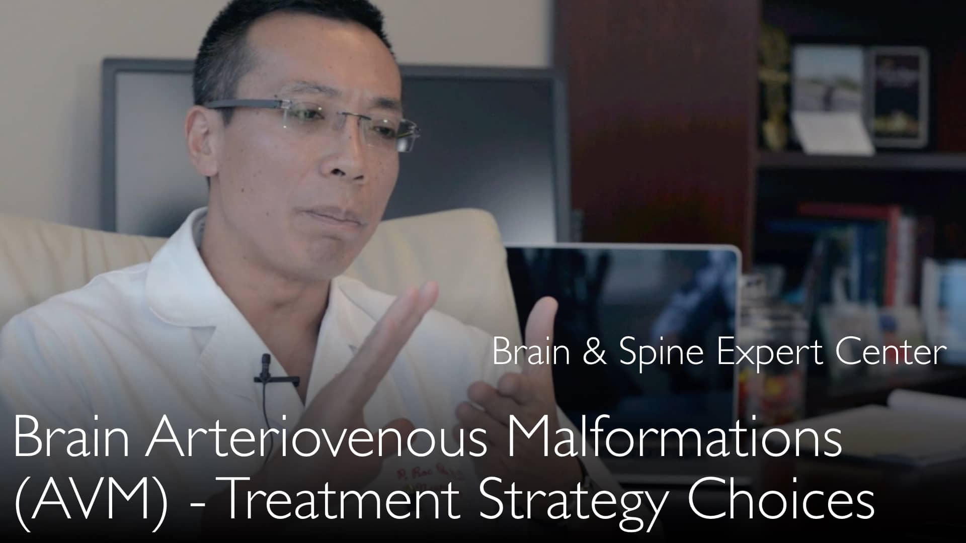 Brain arteriovenous malformation treatment. AVM therapy. 9 ...