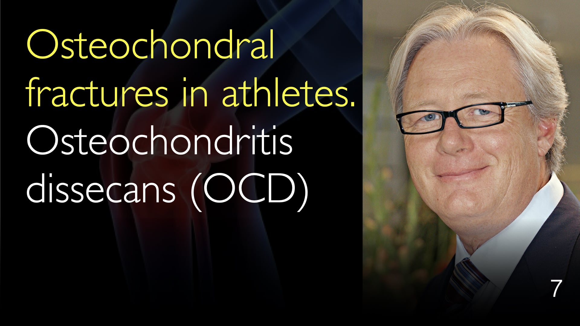 Osteochondral fractures in athletes. OCD, Osteochondritis dissecans. 7 ...